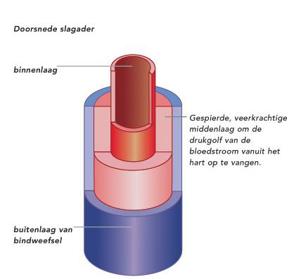 Aortadissectie - Scheurtje in de aortawand